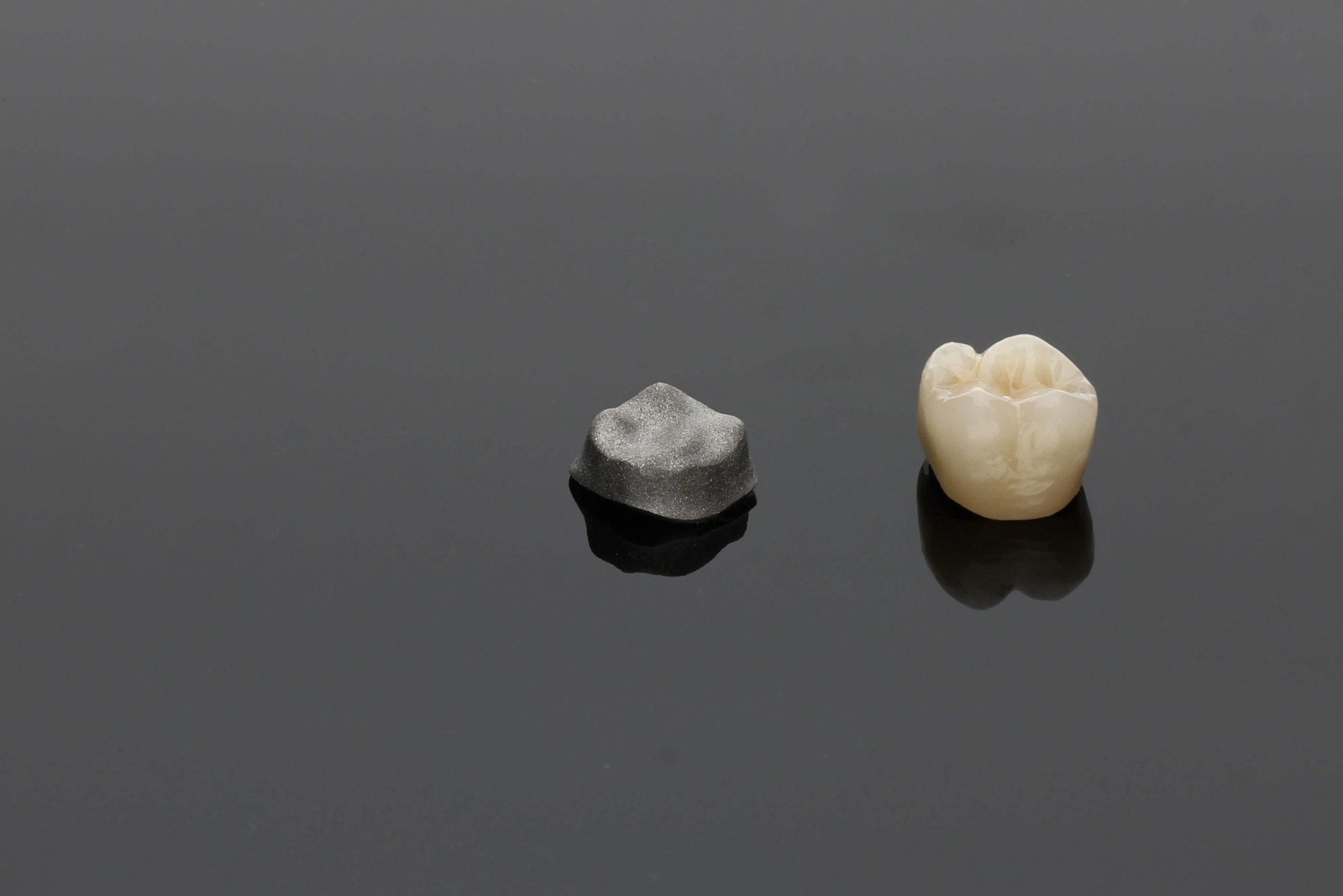 Zinser VMK - Die vollverblendete Qualitätskrone