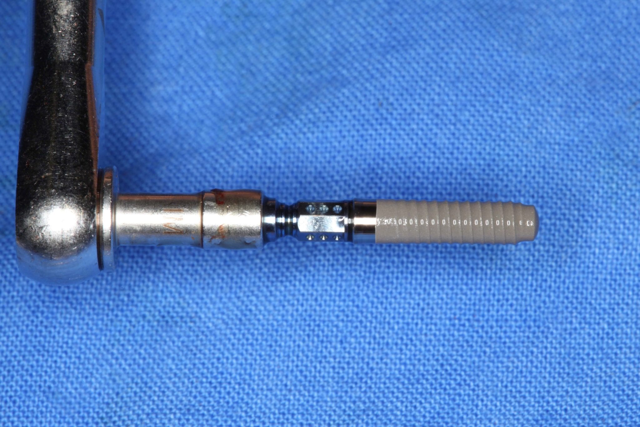 Straumann Pro Arch Konzept im atrophen Unterkiefer